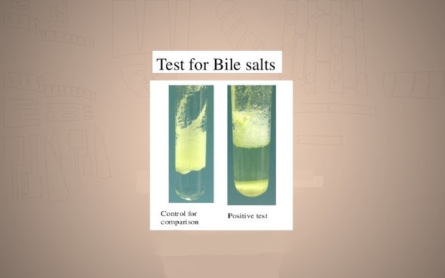 AA Principe et procédure du test des sels biliaires | Massart Santé ...